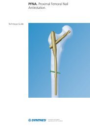 Titanium/Stainless Steel Elastic Nail System. For elastic ... - Synthes