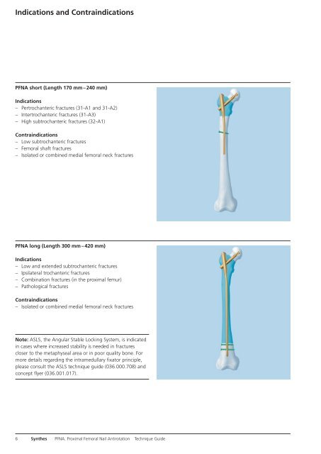 Indications and Contraind
