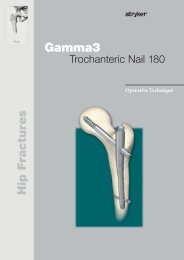 Gamma3 Trochanteric Nail 180 Operative Technique - Stryker