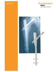 Exeter trauma stem hip hemiarthroplasty