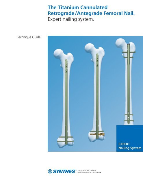 The Titanium Cannulated Retrograde/Antegrade Femoral Nail TG