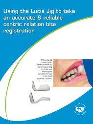 Splint Adjustment Guide - Great Lakes Orthodontics
