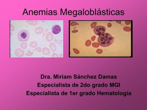 Ac anti factor intrínseco