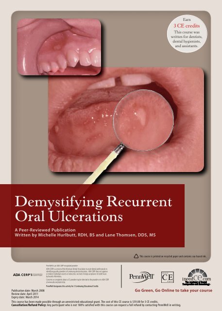 Demystifying Recurrent Oral Ulcerations - IneedCE.com