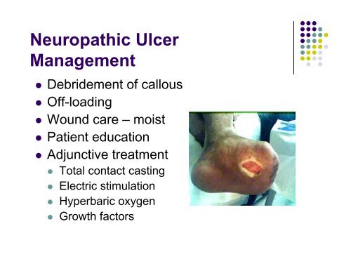 Neuropathic Ulcer Managem