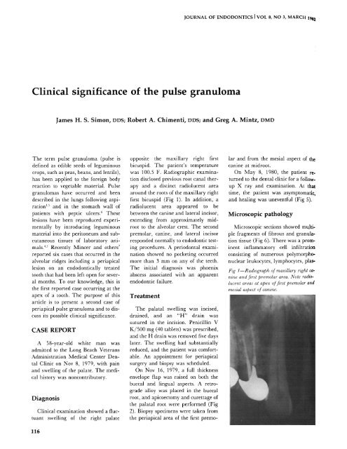 Clinical significance of the pulse granuloma