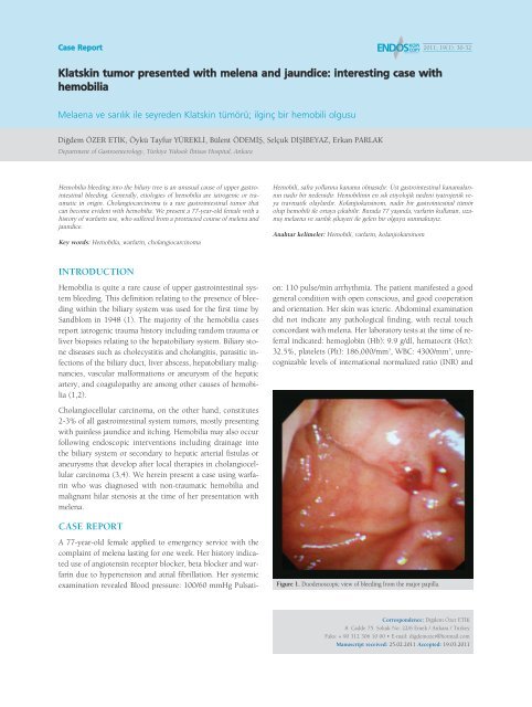 Klatskin Tumor Stages Of