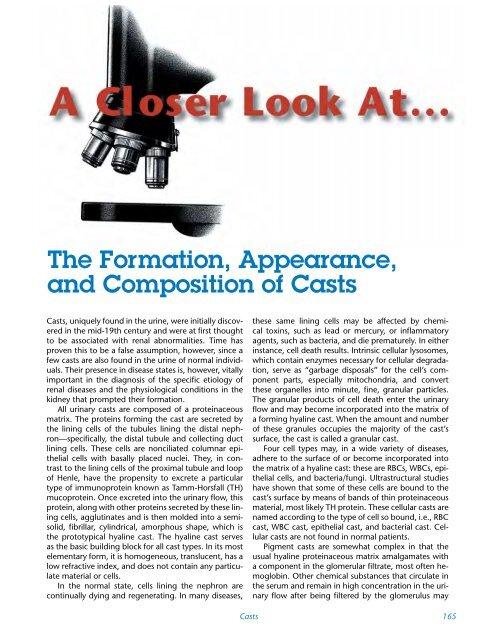 The Formation, Appearance, and Composition of Casts