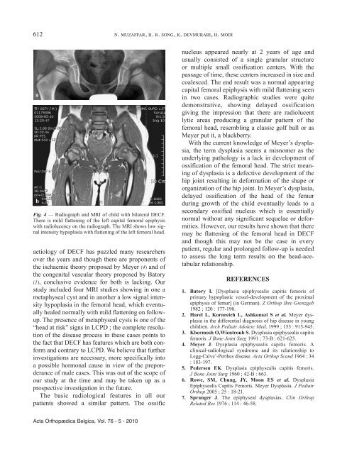 DElAyED OSSIfICAtION Of t