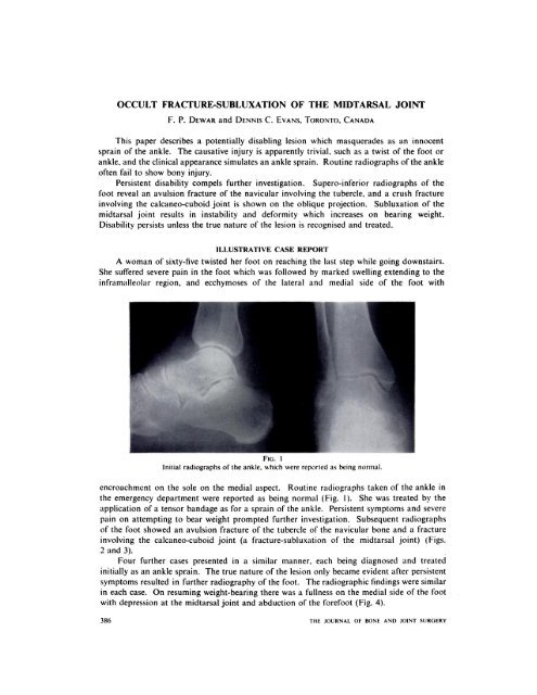 occult fracture-subluxation of the midtarsal joint - The Bone & Joint ...