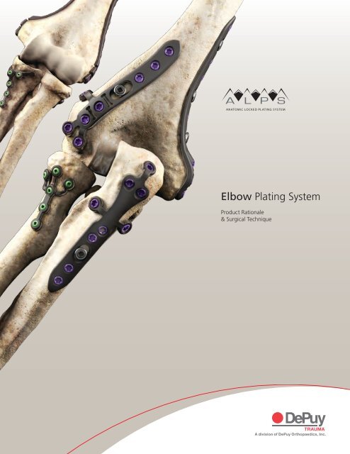 Elbow Plating System Product Rationale & Surgical ... - Biomet