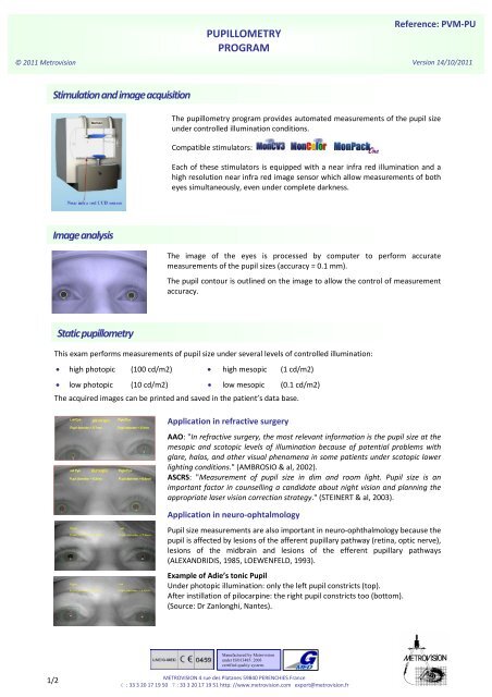 download the PDF brochure - Metrovision