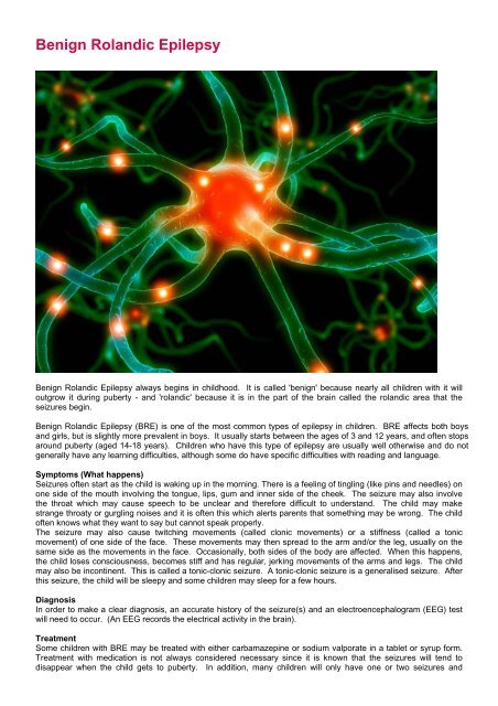 Rolandic Epilepsy Symptoms Causes Diagnosis And Treatment The Next In