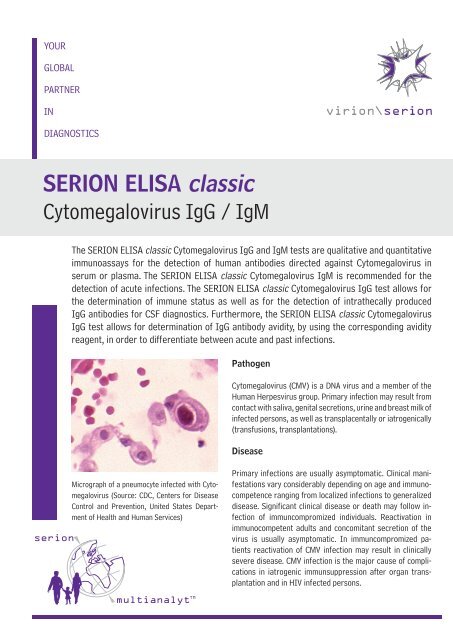 SERION ELISA classic Cytomegalovirus IgG / IgM - virion\serion