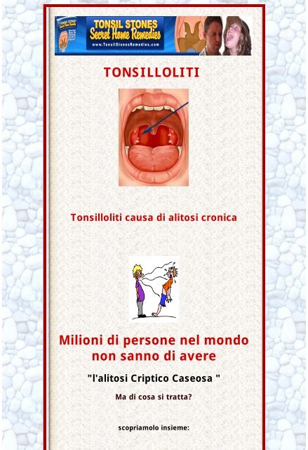 Tonsilloliti: tonsilloliti ... - Alito cattivo
