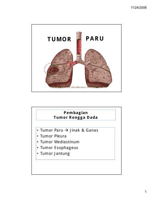 Tumor paru Power point.pdf - E-Lib FK UWKS