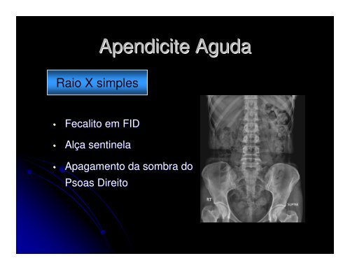 Raio X simples • Fecali