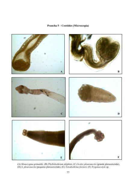 Pracha 4 – Cestóides A