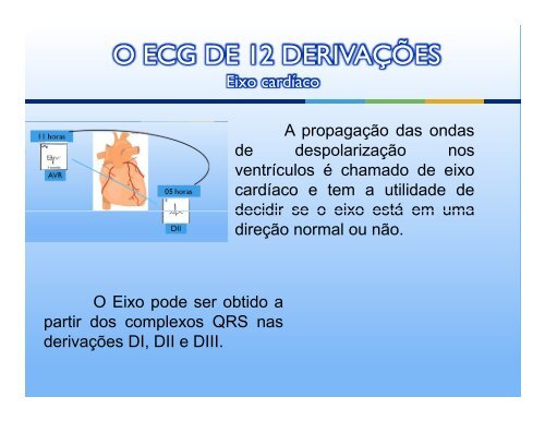 O ECG DE 12 DERIVAÇÕES