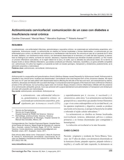 Caso clínico Actinomicosis cervicofacial: comunicación de un caso ...