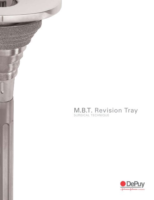 MBT Revision Tray Surgical Technique (DePuy) - PEI