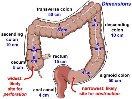 ascending colon 10 cm cec