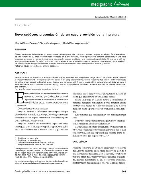 Nevo sebáceo: presentación de un caso y revisión de la literatura