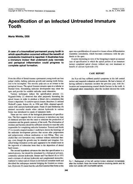 Apexification of an open tooth