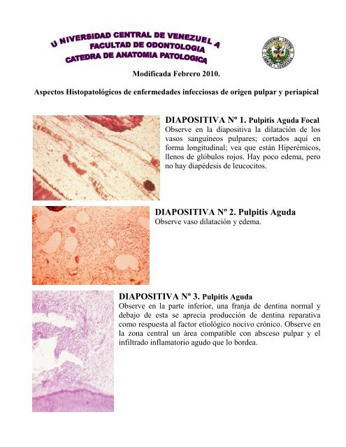 Practica5_Enfermedades_Infecciosas_de_origen_pulpar_y_periapical