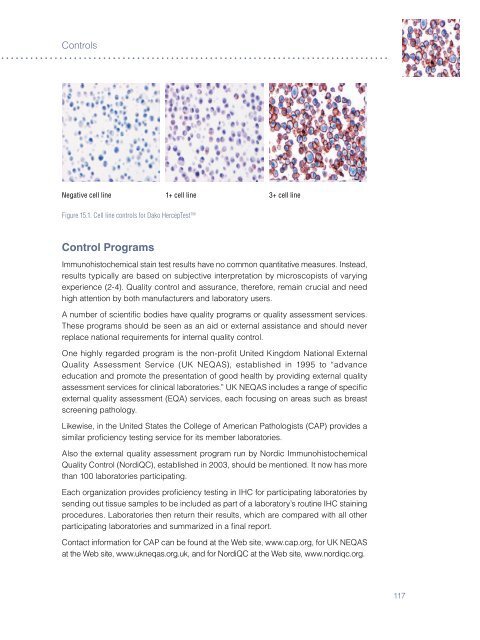 Immunoh stochem cal Sta n