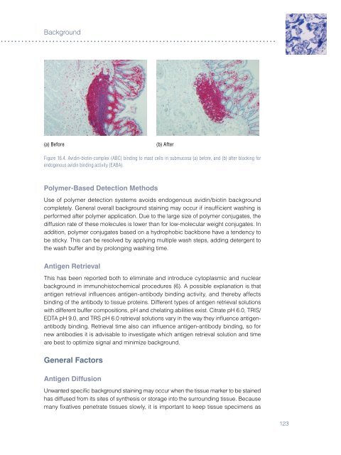 Immunoh stochem cal Sta n