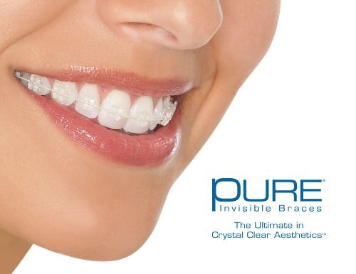 PURE Invisible Braces - Ortho Technology
