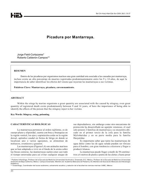 Picadura por Mantarraya.