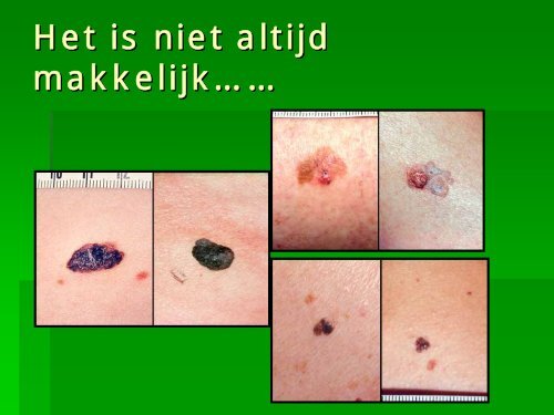 Het is niet altijd makkel