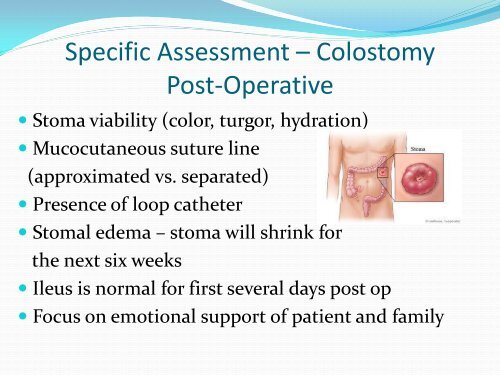 Specific Needs – Colost