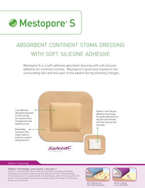 absorbent continent stoma dressing with soft silicone adhesive
