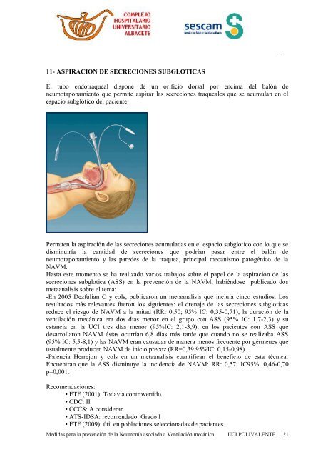 10-ADECUADA PRESION DEL B 10-ADECUADA PRESION DEL B