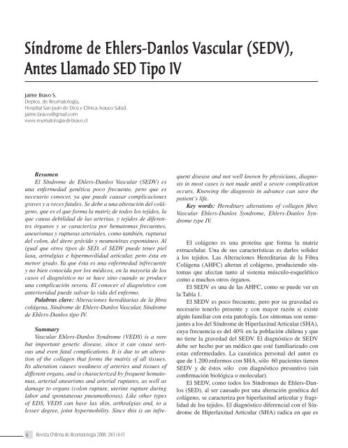 Síndrome de Ehlers-Danlos Vascular (SEDV), Antes Llamado SED ...