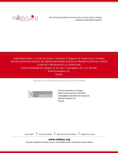 Adenocarcinoma Gastrico Difuso Con Celulas En Anillo De Sello Tratamiento Consejos Celulares