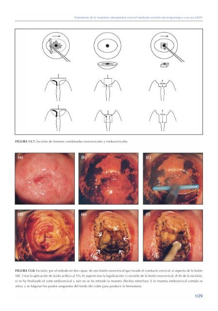 Capítulo 13 escamoso-cil