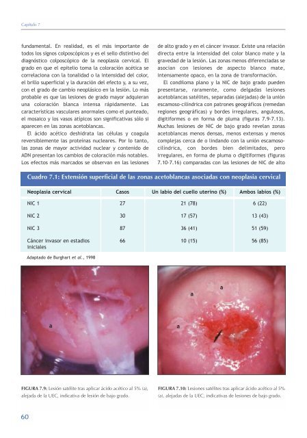Capítulo 7 fundamental.