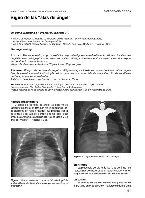 Signo de las “alas de ángel” - SciELO