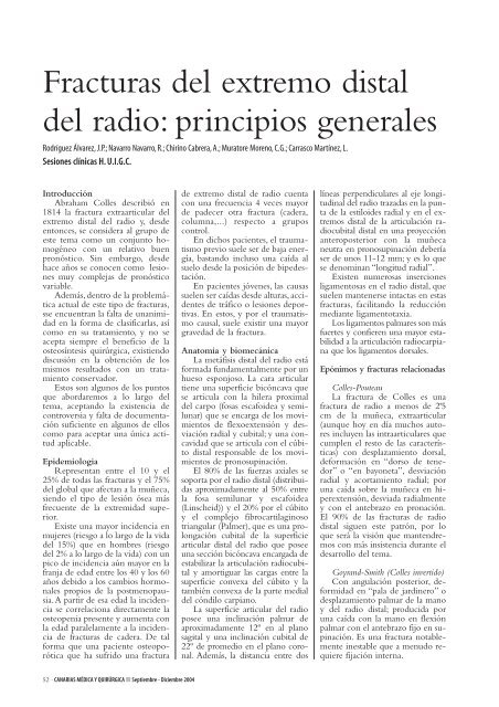 Fracturas del extremo distal del radio: principios generales - Acceda