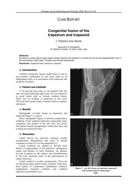 Scaphoid Trapezium Trapezoid Joint