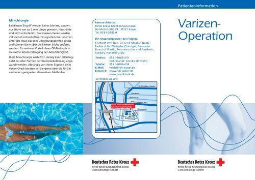 Varizen-Operation - Rotes Kreuz Krankenhaus Kassel