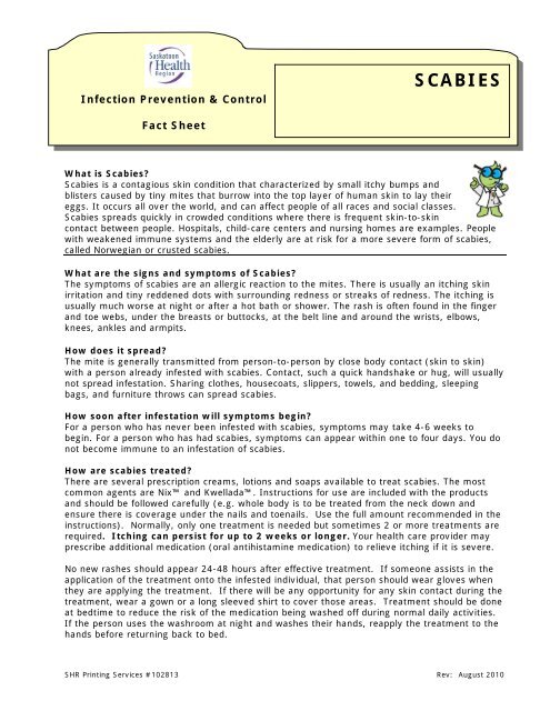 IPC Scabies Fact Sheet - Saskatoon Health Region