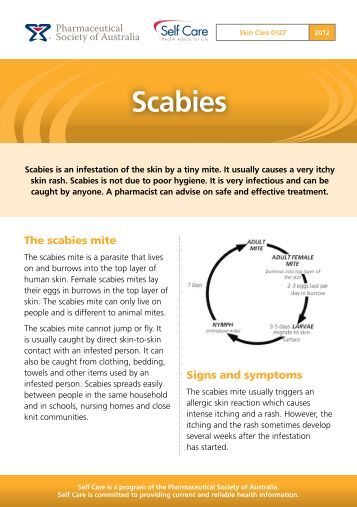 Scabies: How is it treated? Patient Information Leaflet