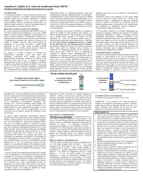 AmniSureâ ¢ Fetal Membrane Rupture Test - AmniSure International ...