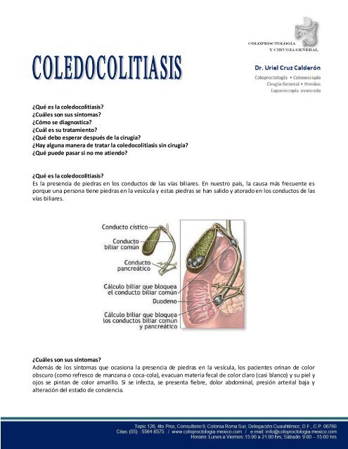 ¿Qué es la coledocolitiasis? ¿Cuáles son sus síntomas? ¿Cómo se ...