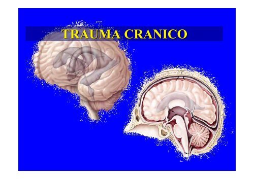 TRAUMA CRANICO - Medicina e Chirurgia